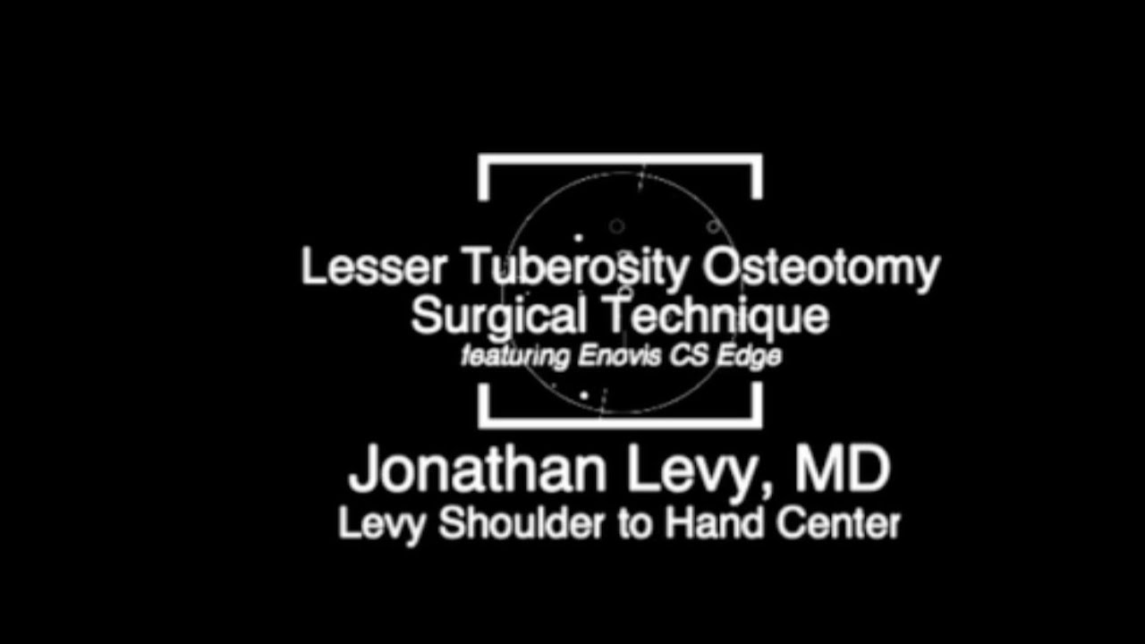 Lesser Tuberosity Osteotomy Technique Using Stemless Anatomic Total ...