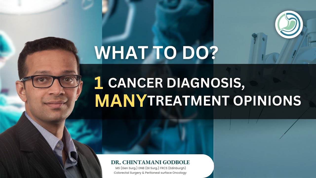 Role of MDT in cancer care | Tumors board | Top cancer surgeon Mumbai ...