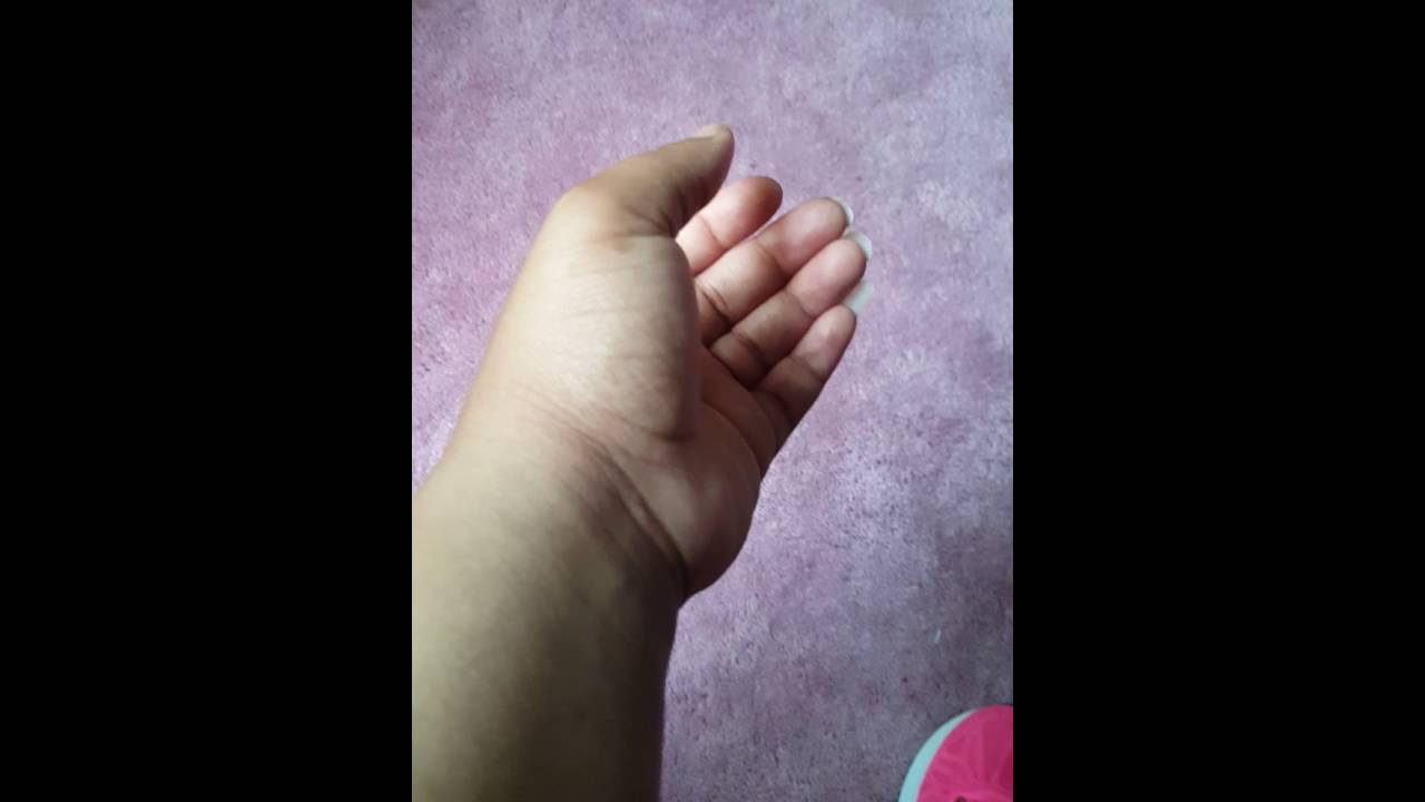 Longer video of Twitching Hand lol - YouTube