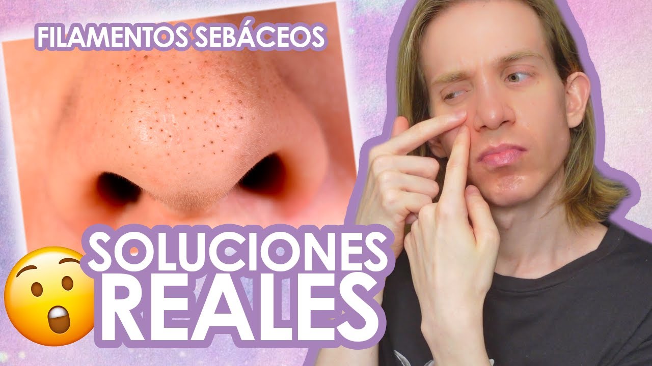 FILAMENTOS SEBACEOS: IDENTIFICARLOS y ELIMINARLOS de manera eficaz ...