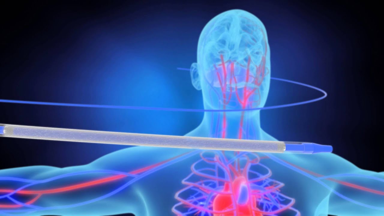 3D animation - ELUTAX SV - YouTube