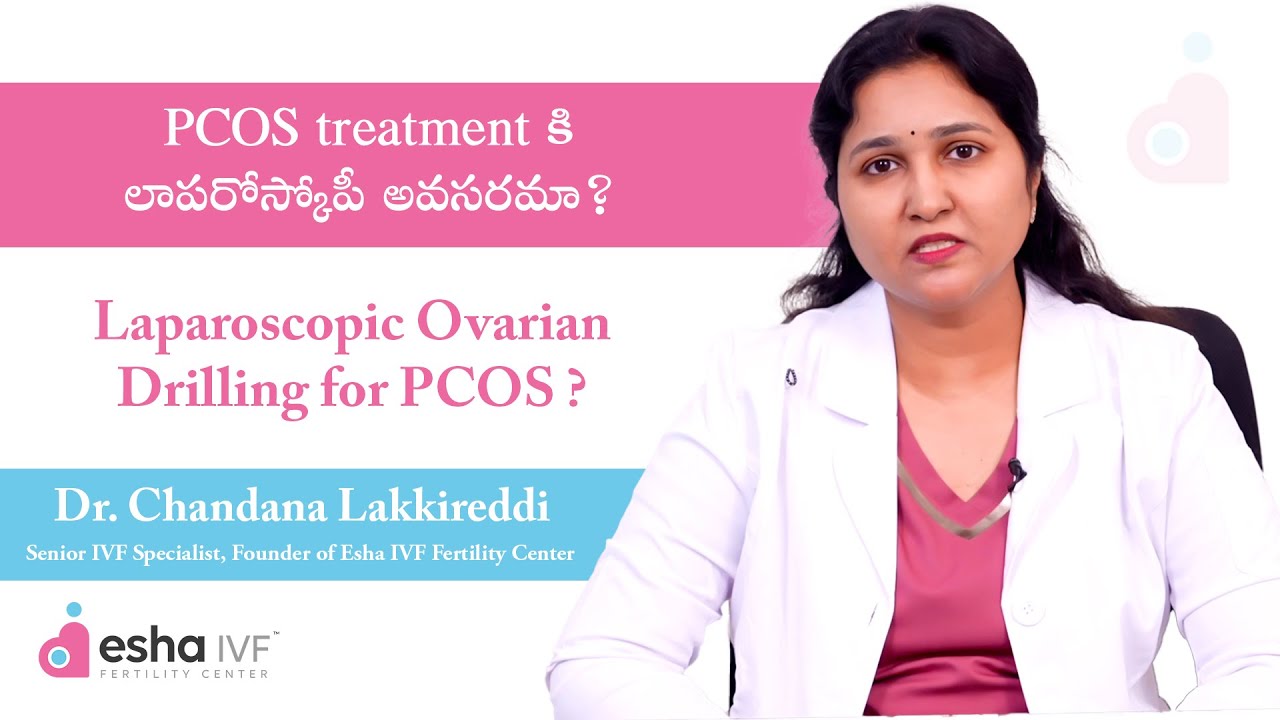 Laparoscopic Ovarian Drilling for PCOS | PCOS treatment కి లాపరోస్కోపీ ...