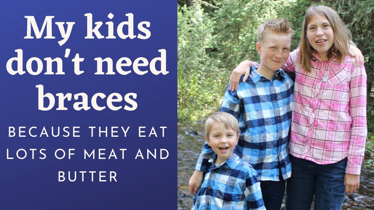 Our Meat Heavy Diet My Kids Don t Need Braces YouTube our-meat-heavy-diet-my-kids-don-t-need-braces-youtube