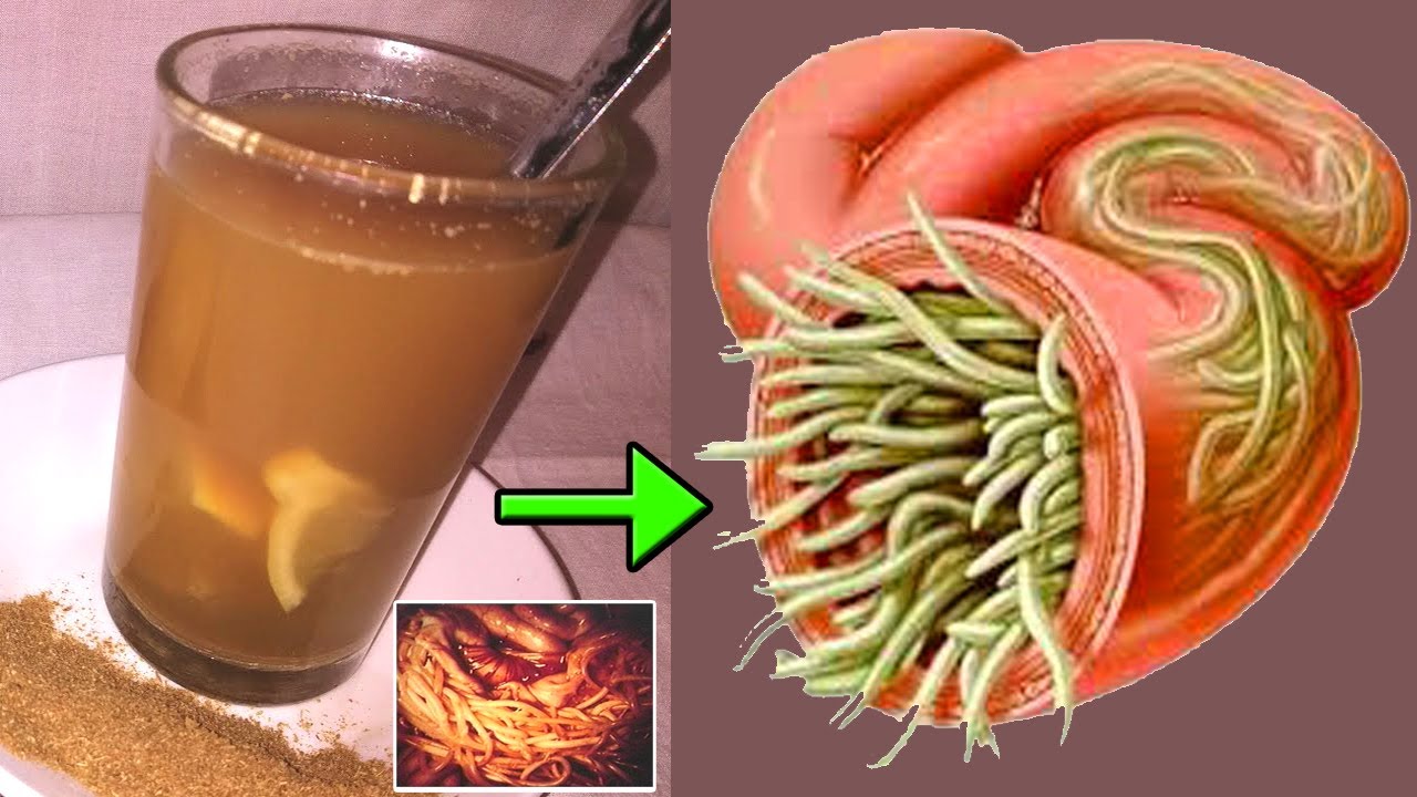 Get Rid Of Intestinal Worms In No Time! The Chinese medicine To Get rid ...