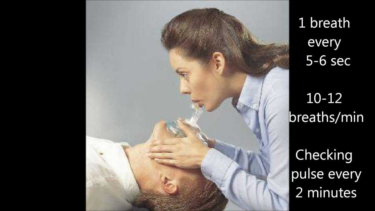 ACLS Respiratory Arrest Scenario Prepare for a Test 10 Questions - YouTube