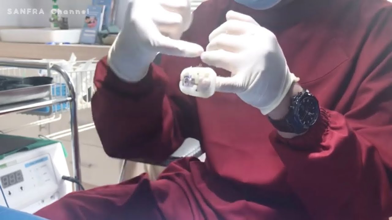 KHITAN METODE SMART KLAMP DI KLINIK MUTIARA CIKUTRA BANDUNG - YouTube