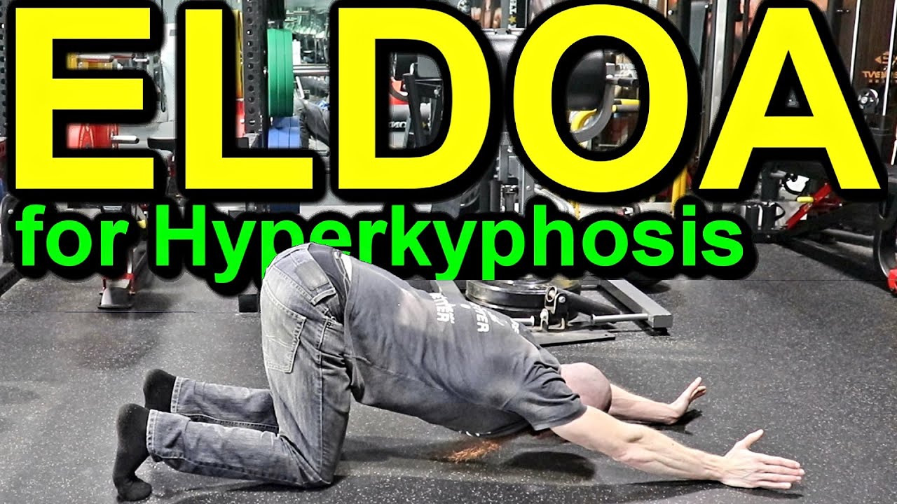 HOW TO CORRECT THORACIC HYPERKYPHOSIS: Top 5 ELDOA Exercises for Hyperkyphosis Posture ...