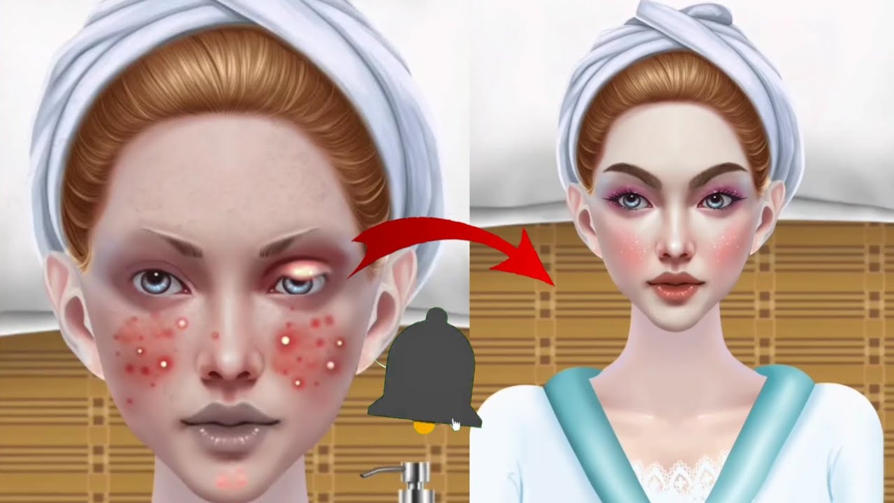 ASMR Acne & Black Head Pimple Removal - Acne Deep Cleaning Animation ...