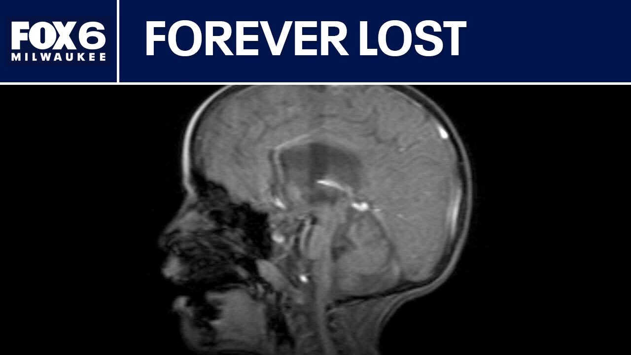 Children's Wisconsin 'profoundly sorry' for throwing out donated brain ...