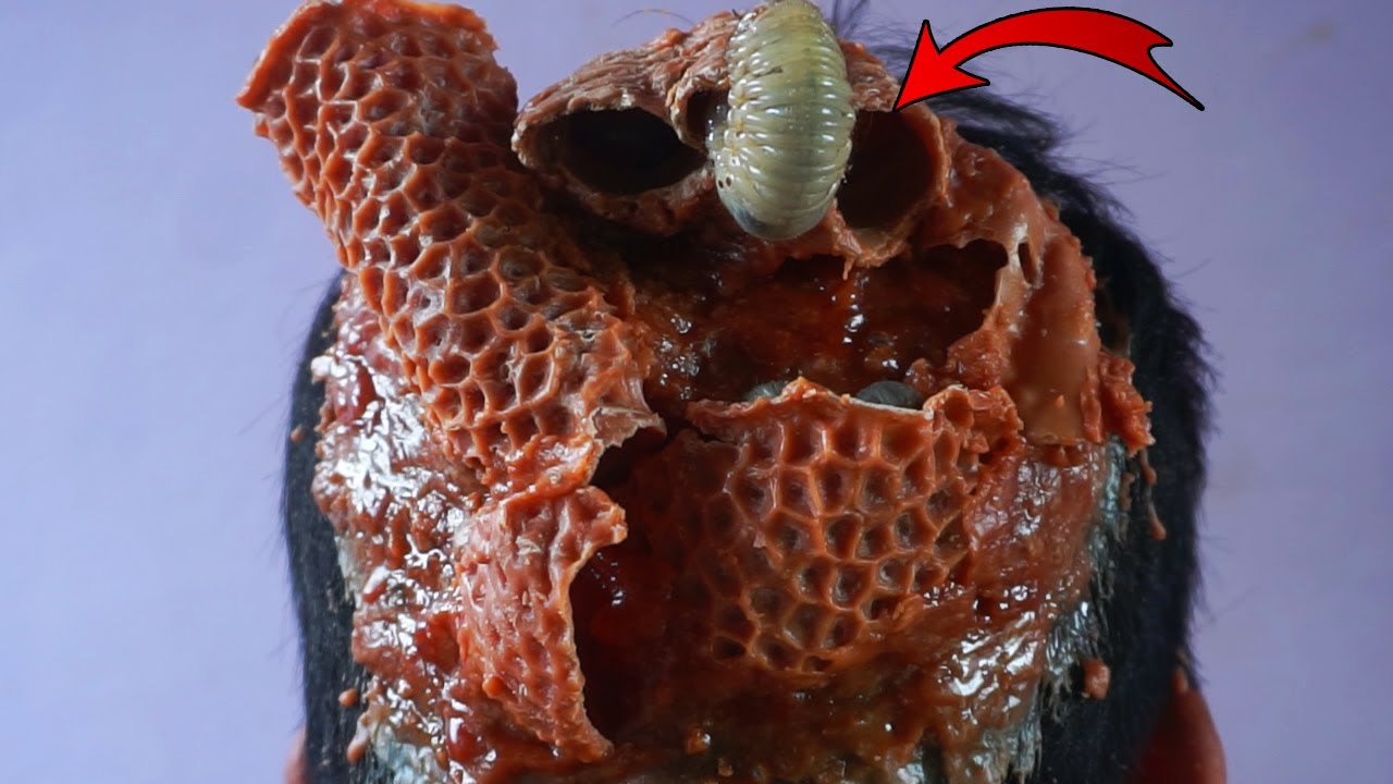 Life Definitely Sad!! Scratch Scratch Scratch Worm Worm Worm On Head ...