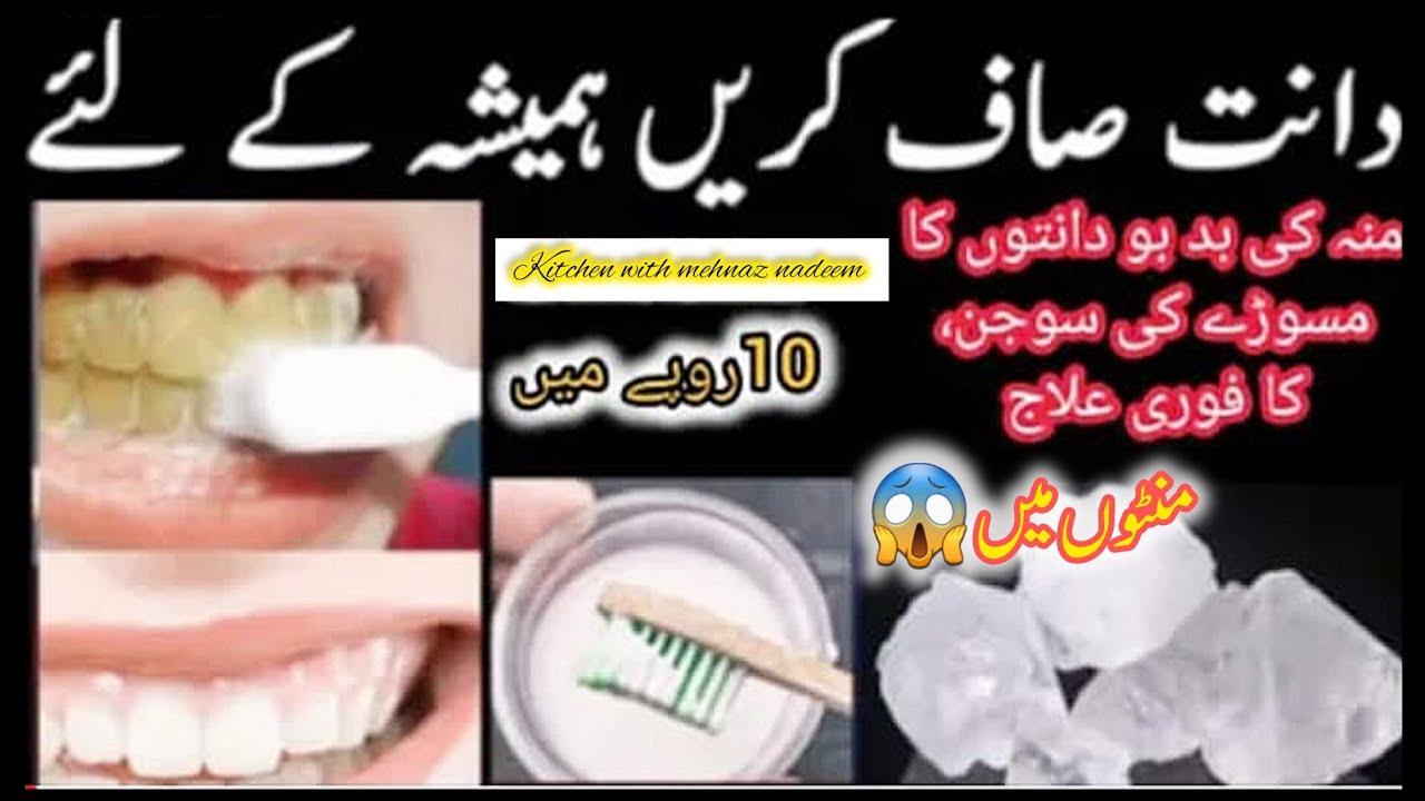 How to clean your teeth within just 1 week | Best homemade remedy ...
