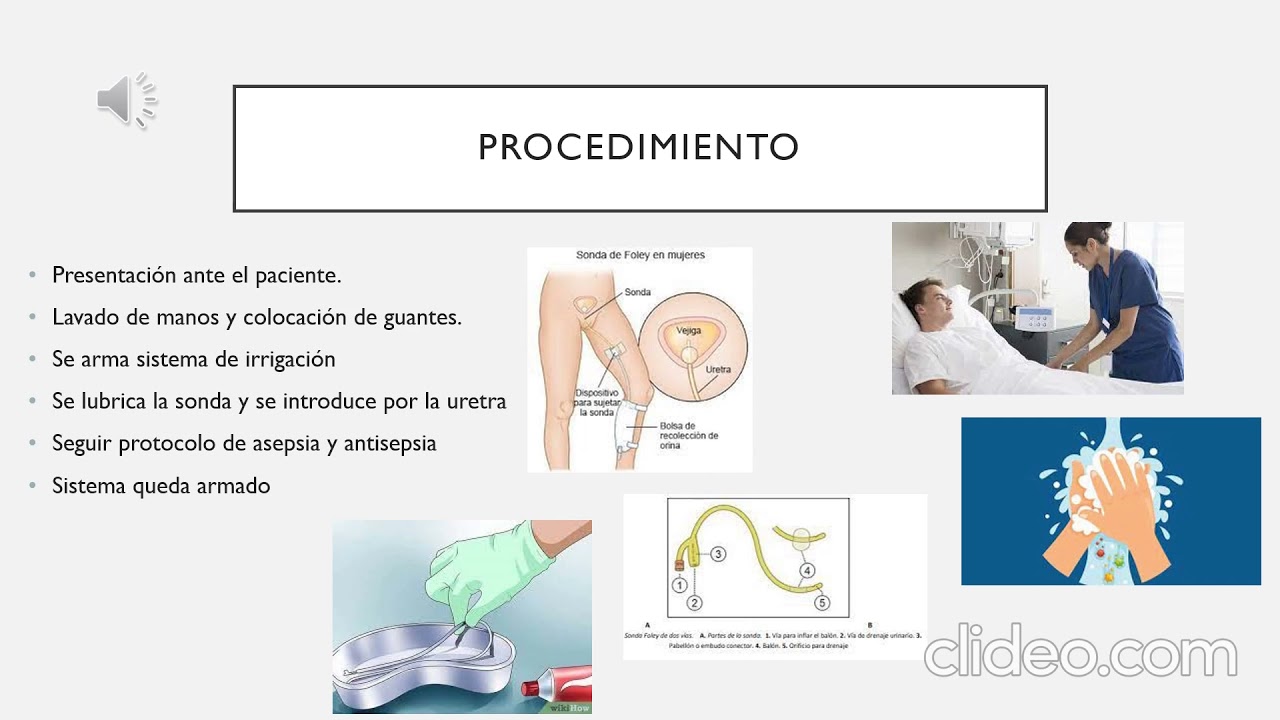 Cistoclisis - YouTube