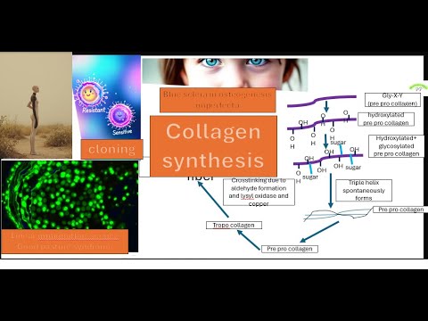 Collagen synthesis-disorders(Osteogenesis imperfecta,stickler.)/ Homocystinuria/Cloning and ...