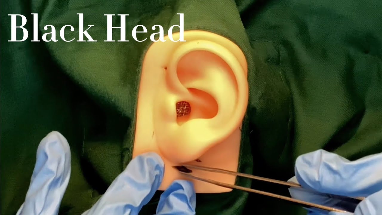You Will Feel Sleepy ASMR Black Head and Massage Ears 🥱😴💤 - YouTube
