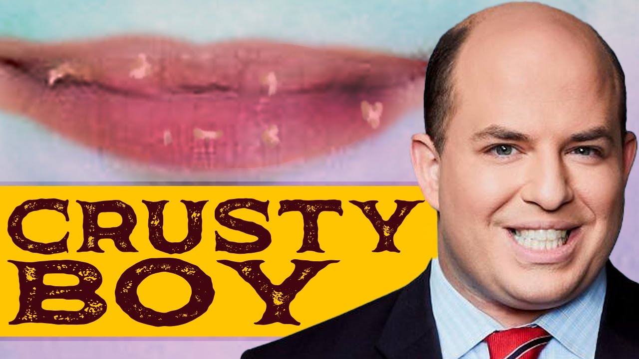 Brian Stelter: Crustiest Lips in America - YouTube