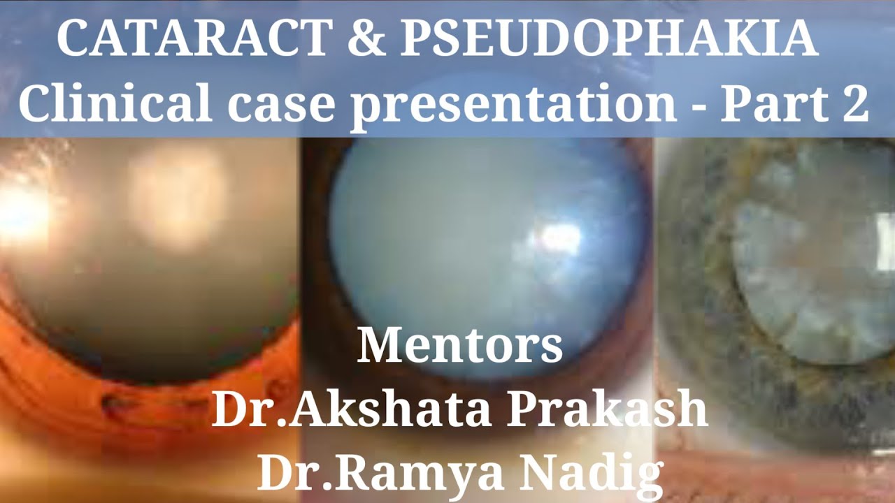 CATARACT & PSEUDOPHAKIA Clinical case presentation - Part 2 - YouTube