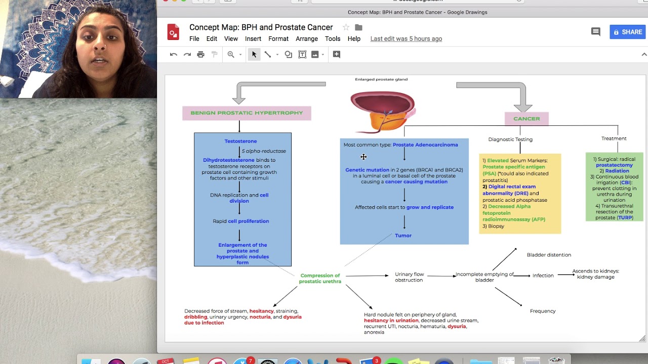 Final Concept Map-BPH and Prostate Cancer - YouTube