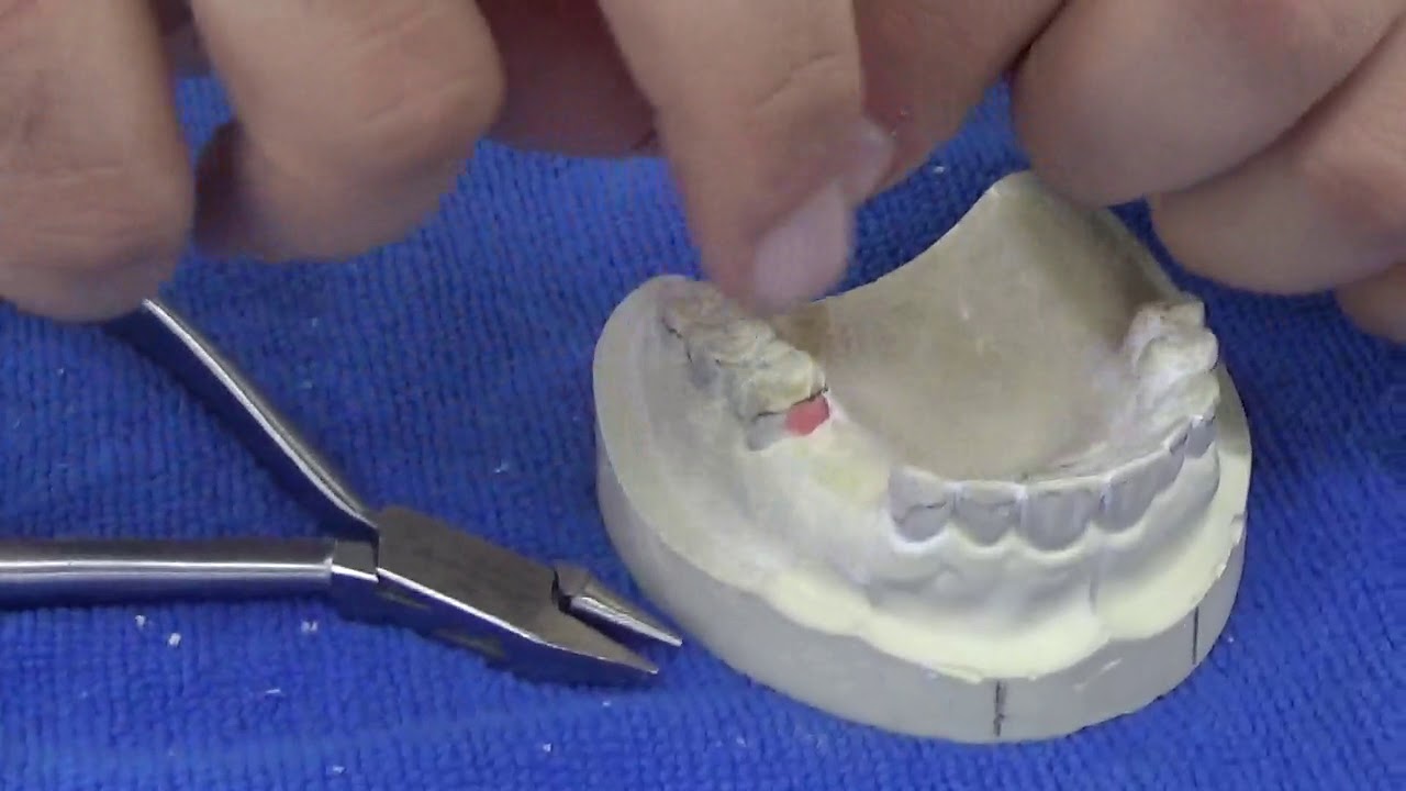 Partial denture wire bending 2 - YouTube