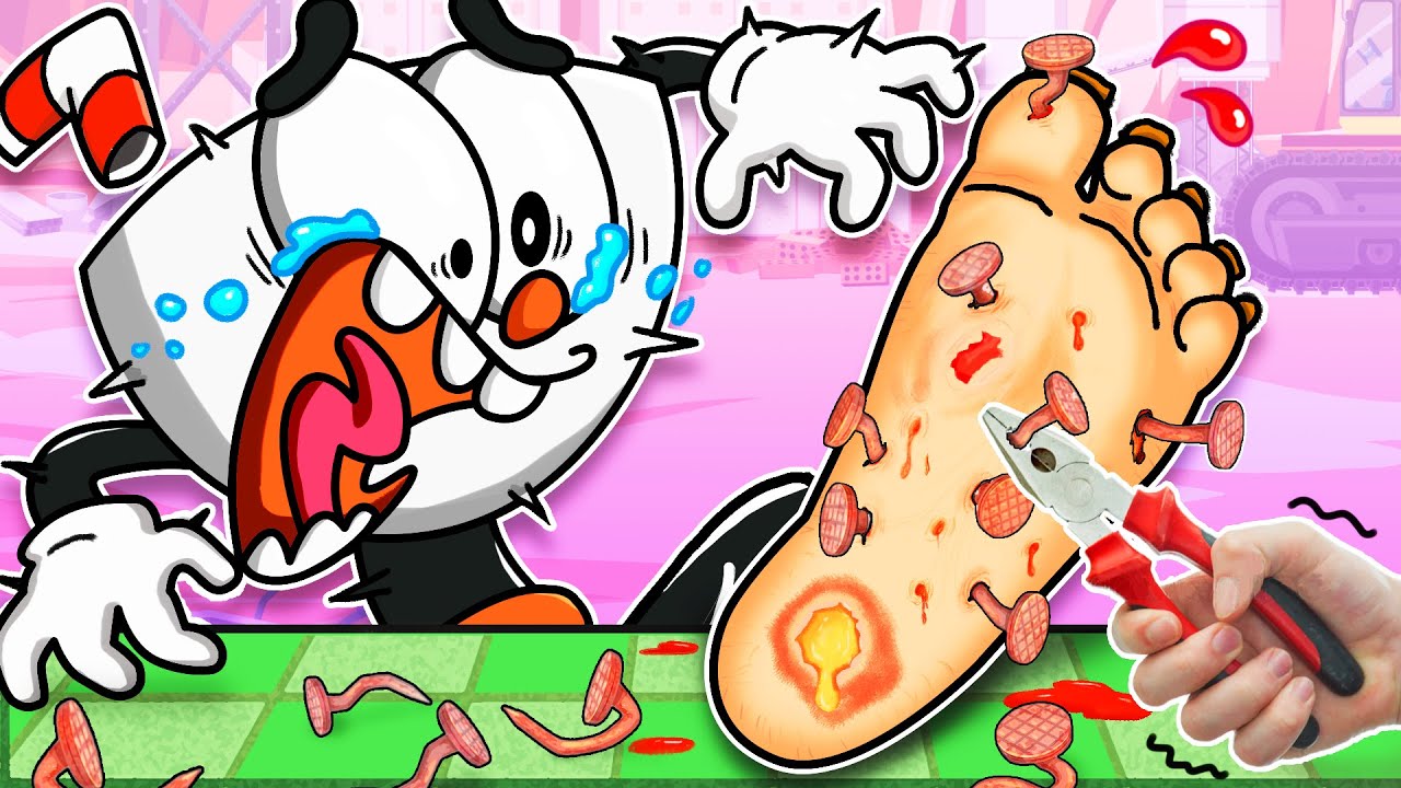 S O S Cuphead Stepped On Nails || How To Athlete's Foot Treatment ...