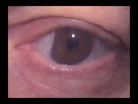 unblinking eye - YouTube