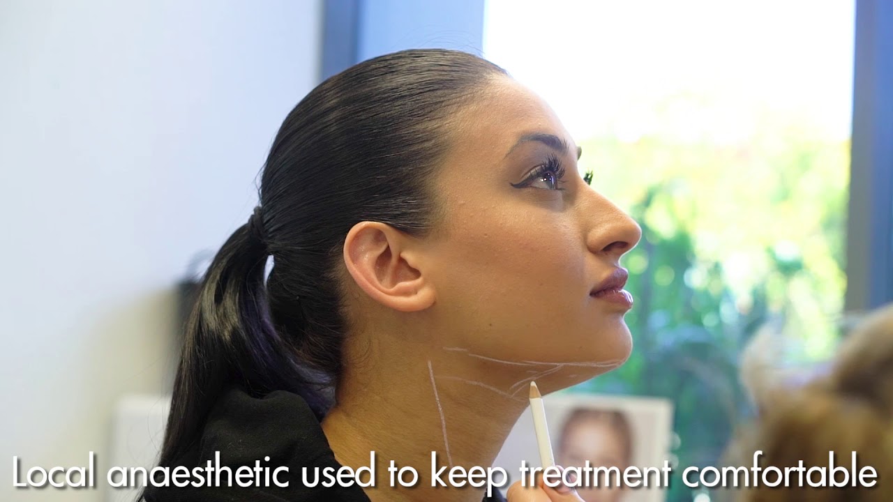 Double Chin Fat Dissolving Injections on the Gold Coast - YouTube