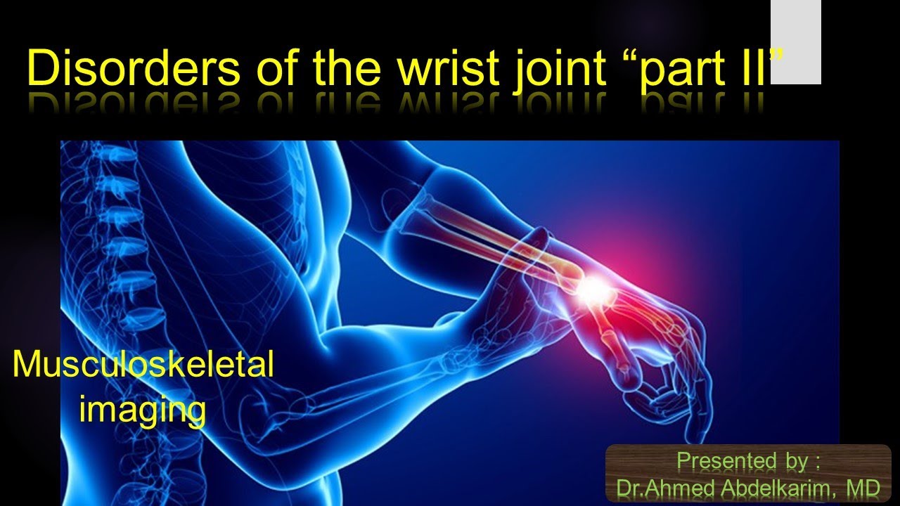 8-Disorders of the wrist "part II" - YouTube