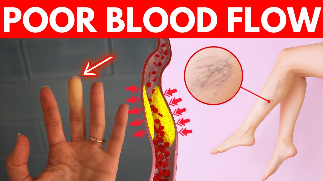 12 Causes Of Poor Blood Circulation To Be Aware Of - YouTube