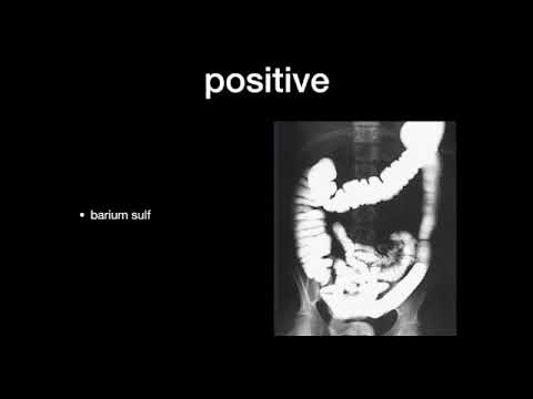 Contrast media - YouTube