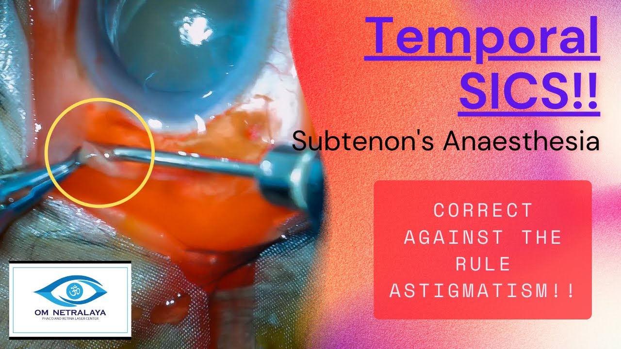 Case series 11. Temporal SICS , Subtenon's Block and correct against ...