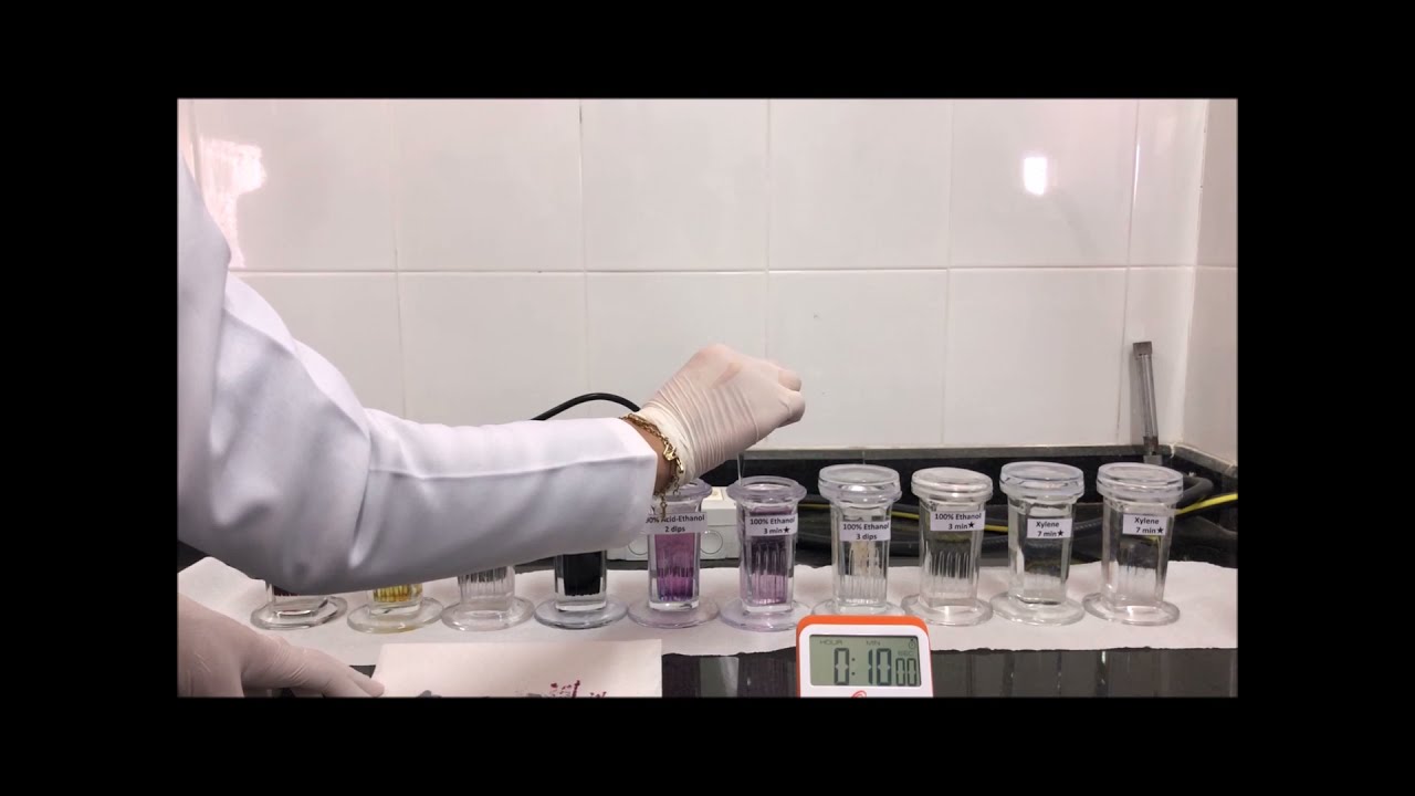 Trichrome stain of fecal smears: detailed procedure - YouTube