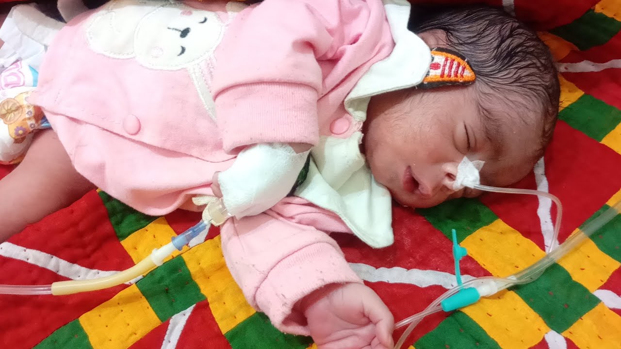 Baby's Condition Is Very Critical | Grade 3 ANN + Grunting | Parents in ...