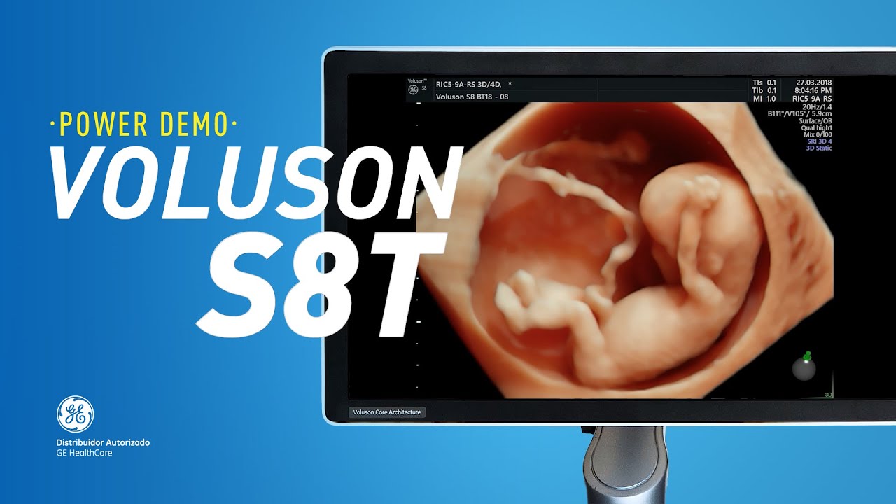 POWER DEMO - GE VOLUSON S8T - YouTube