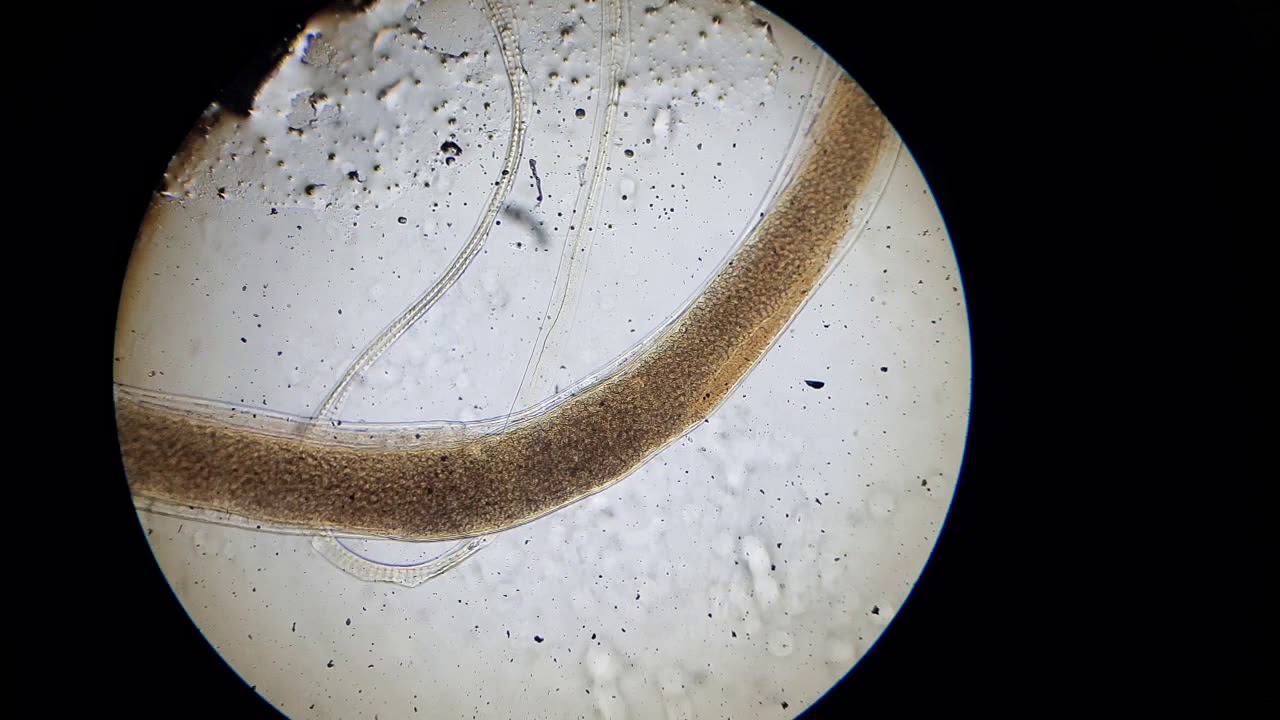 p9 Trichuris trichiura_female adult worm - YouTube