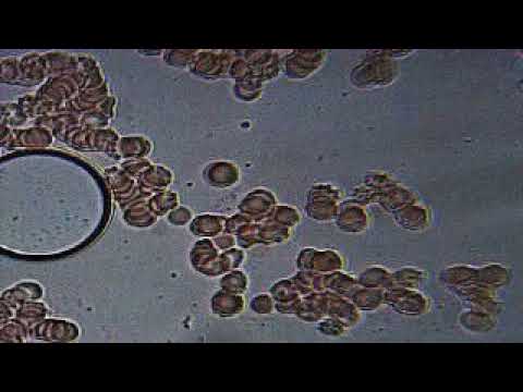 Blood Cells 40X - YouTube
