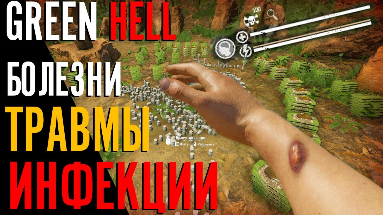 Как ЛЕЧИТЬ ТРАВМЫ, БОЛЕЗНИ, ИНФЕКЦИИ В Green Hell | Гайд - YouTube