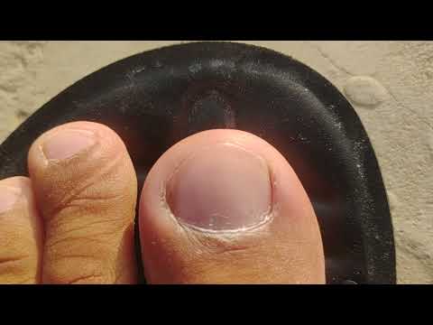Foot finger video new latest black shows