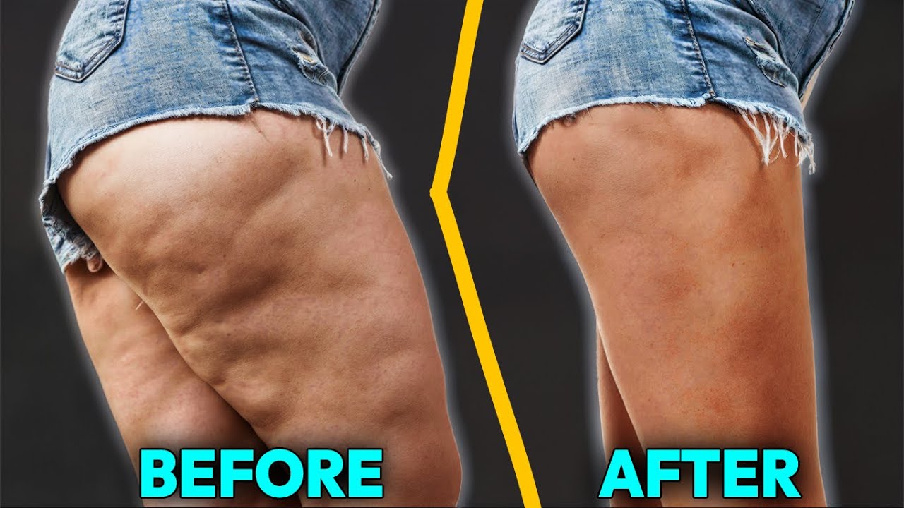 CELLULITE FREE LEGS | WOMEN'S SECRET BEDROOM WORKOUT - YouTube