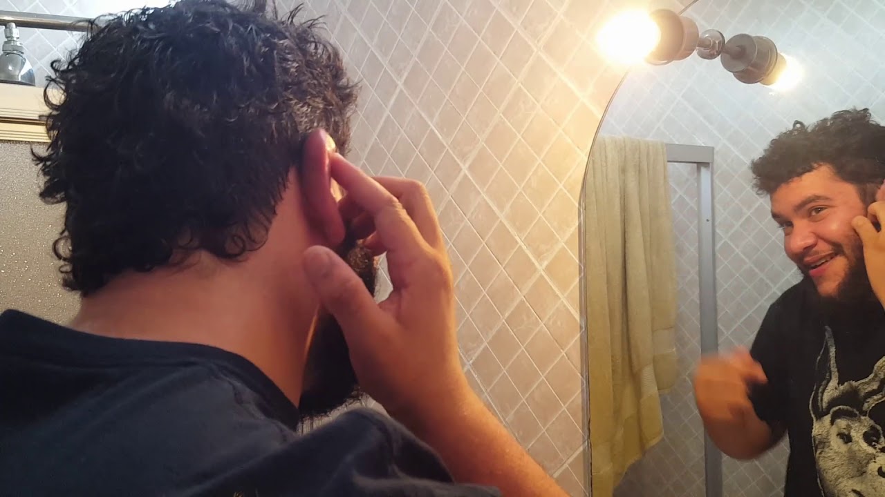 Oreja de coliflor, el sindrome del luchador - YouTube