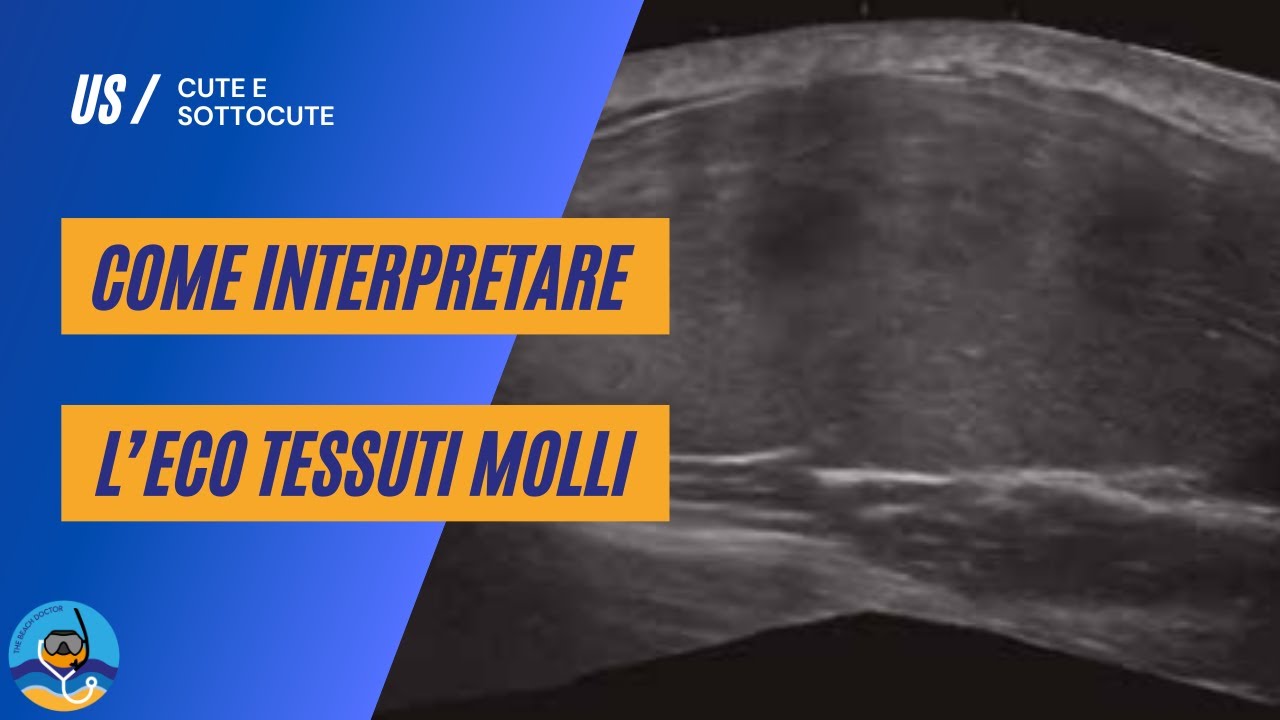 Come interpretare l'eco tessuti molli (parte 2) - YouTube