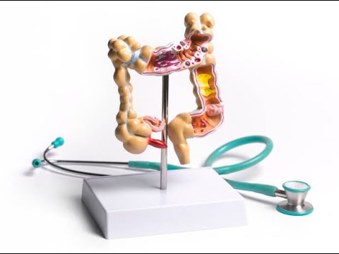 Laparoscopic Extended Right Colectomy, CME - vascular anatomy - YouTube
