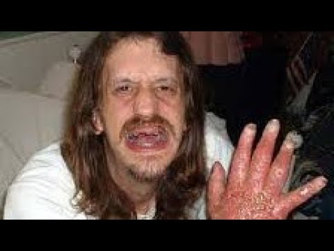 Getting A Ride From The Crazy Meth Head - YouTube