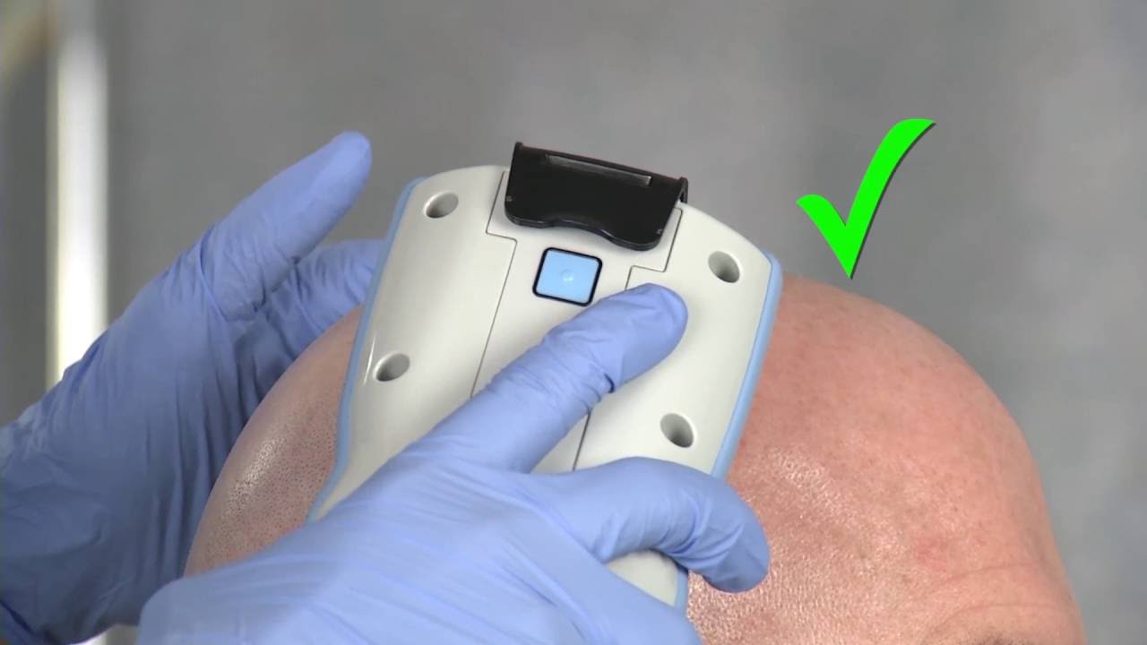 Infrascanner 2000 - Detailed User Guide - YouTube