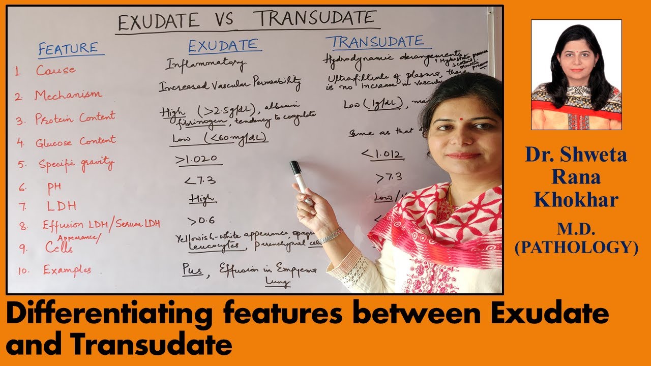Exudate vs Transudate: Differentiating features between Exudate and ...