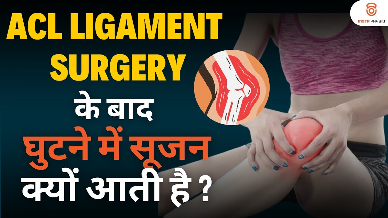 ACL Ligament Surgery के बाद घुटने में सूजन ? Causes and Treatment ...