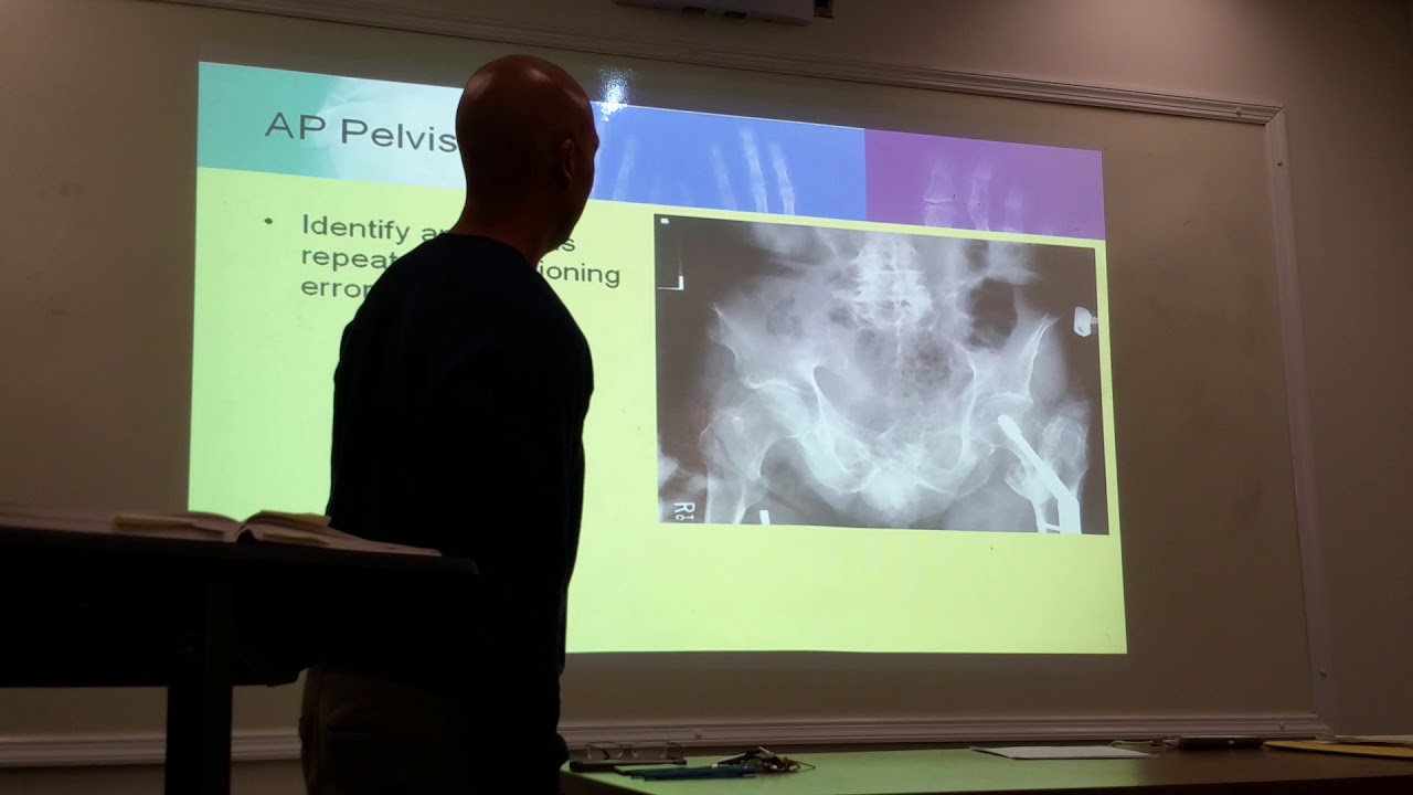 Rad 150 Lecture 8: video 6 of 6 - YouTube