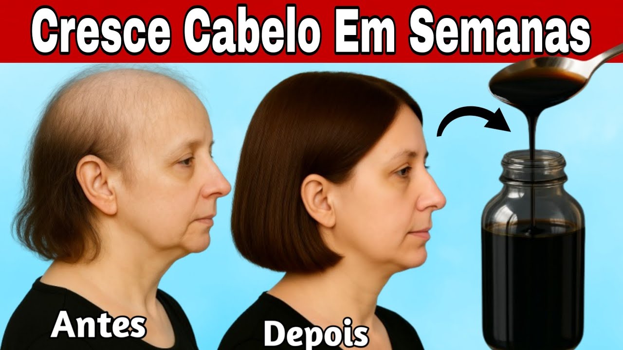 CABELO CRESCE EM SEMANAS | Receita Potente Para Crescer Cabelo - YouTube
