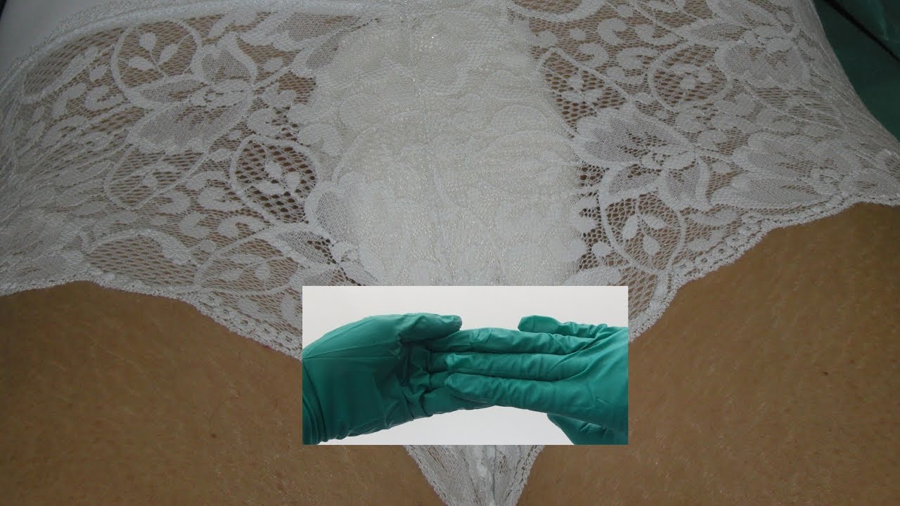 Himenoplastika - vraćanje nevinosti ili pomlađivanje vagine ...