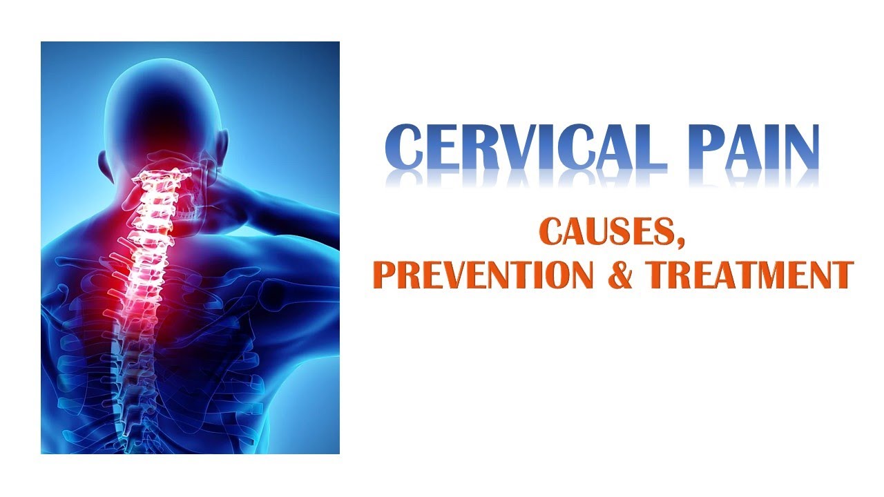 CERVICAL PAIN: Causes, Prevention and Treatment - YouTube