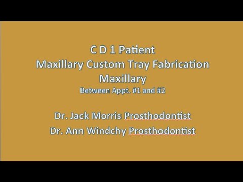 Video #6 - C D Pt #1 Construct Maxillary Custom Tray - Triad - YouTube