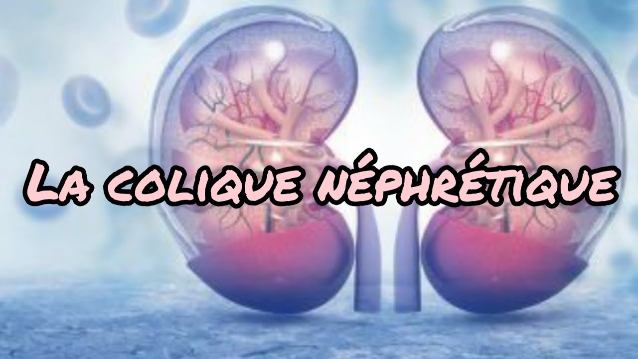 la colique néphrétique, cour paramédical - YouTube